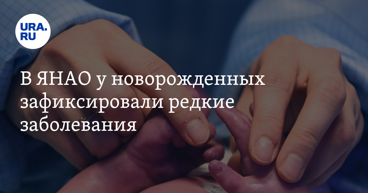 В ЯНАО у новорожденных зафиксировали редкие заболевания